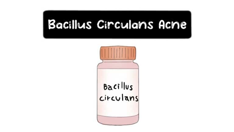 Bacillus Circulans: Definition, Acne And Pathogenicity - Probiotic ...